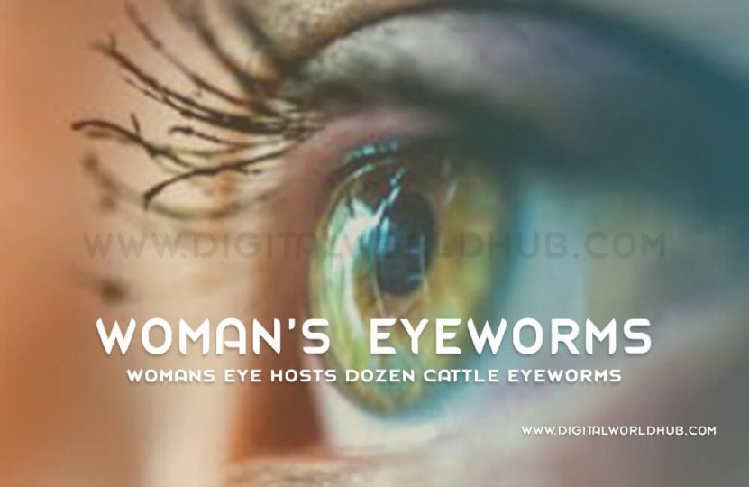 Womans Eye Hosts Dozen Cattle Eyeworms | Digital World Hub